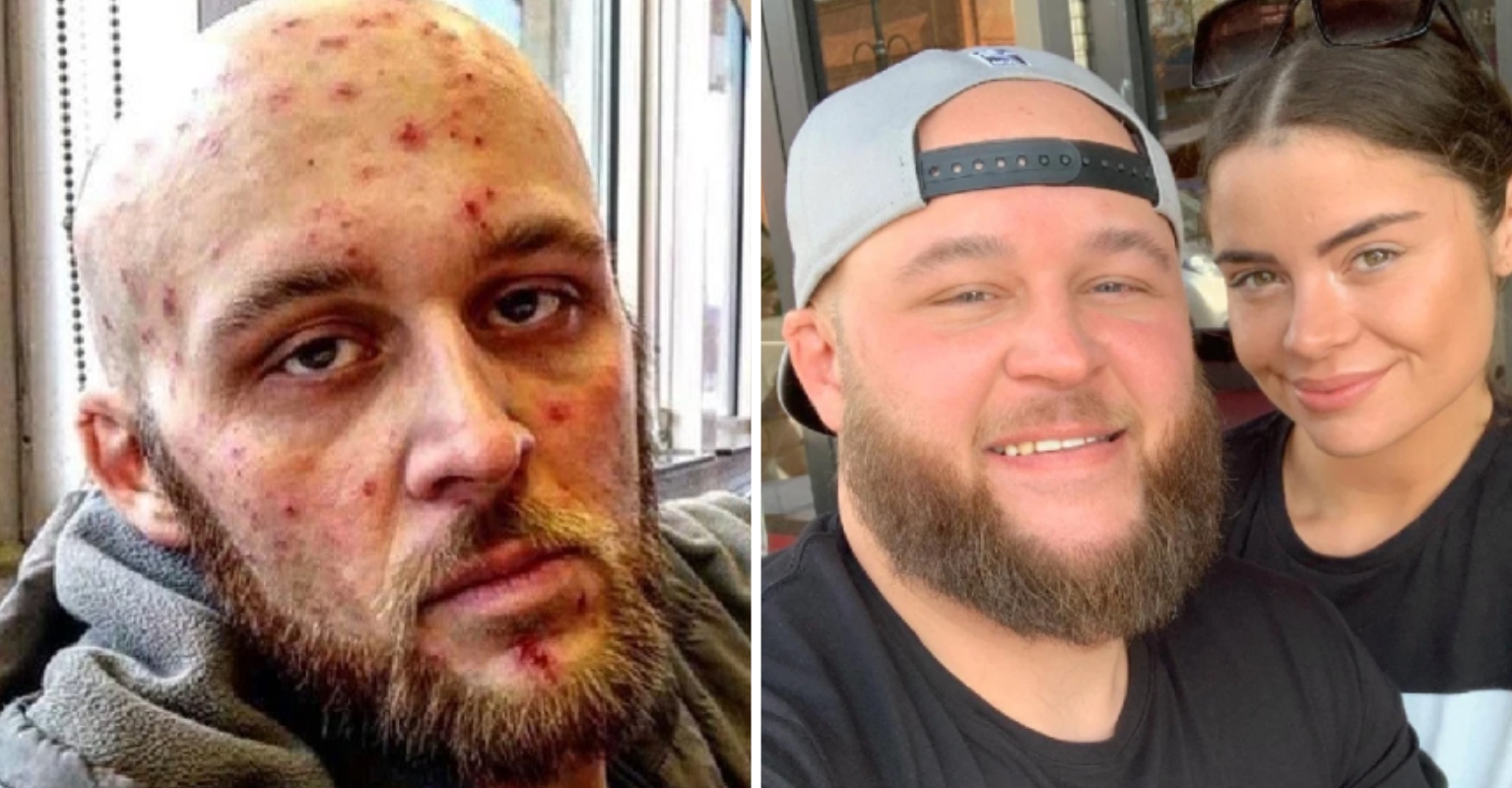 Heroin Addict Looks Like A New Man After Celebrating 32 Months Sober
