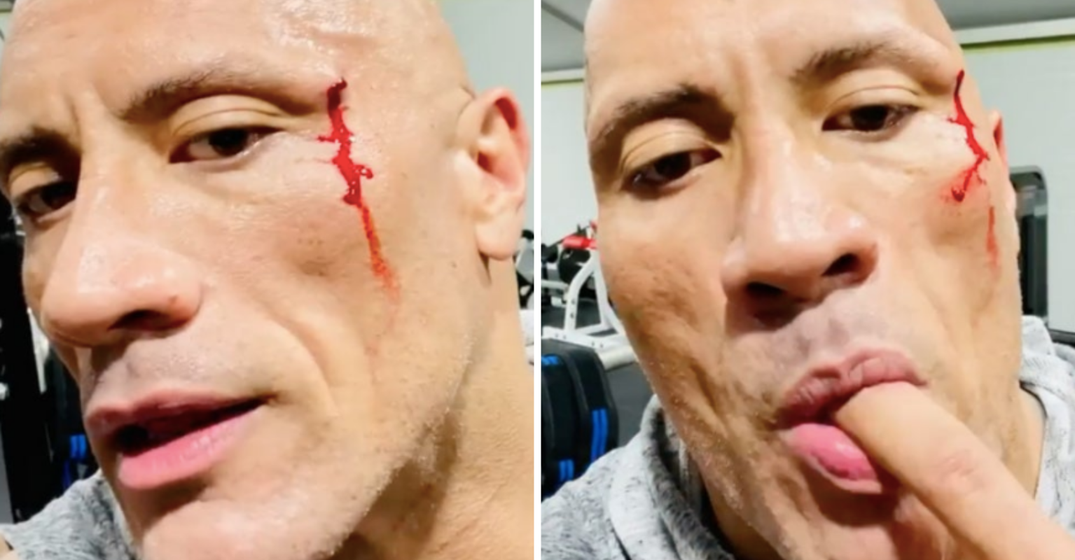 Dwayne 'The Rock' Johnson Shares Gruesome Injury He Suffered While ...