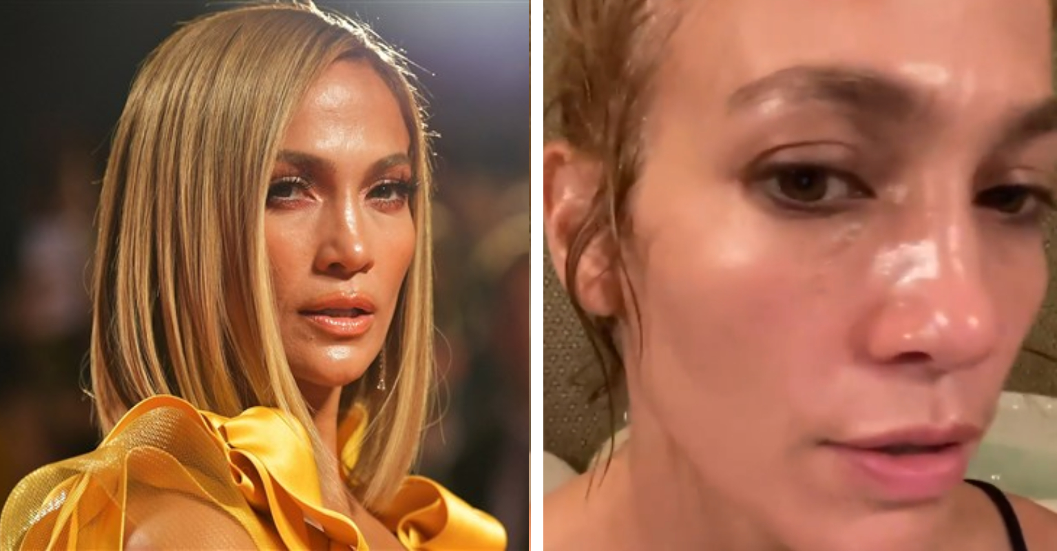 Jennifer Lopez Fires Back At Fan Who Accused Her Of Using Botox