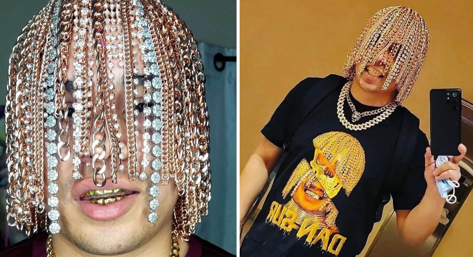 Rapper Has Gold Chains For Hair Hanging From Hooks 'Surgically ...