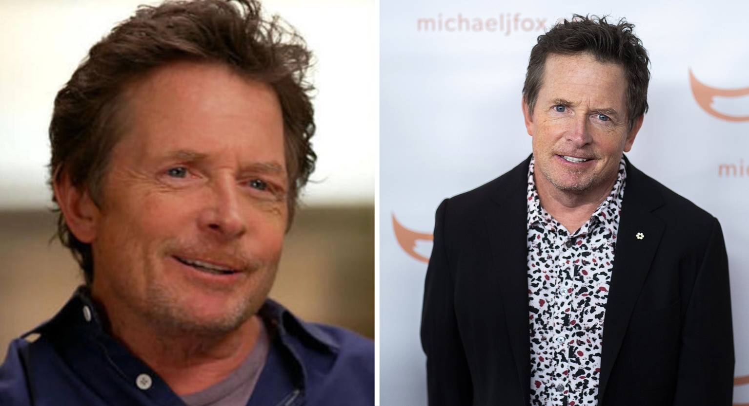 Michael J. Fox Reflects 30 Years After Parkinson's Diagnosis: 'I Still ...