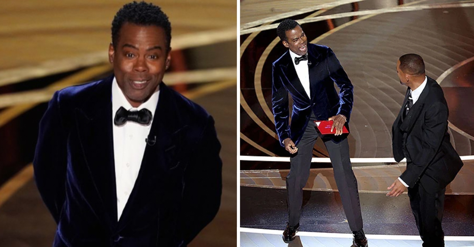 No, Chris Rock Was Not Wearing A Cheek Pad When Will Smith Slapped Him