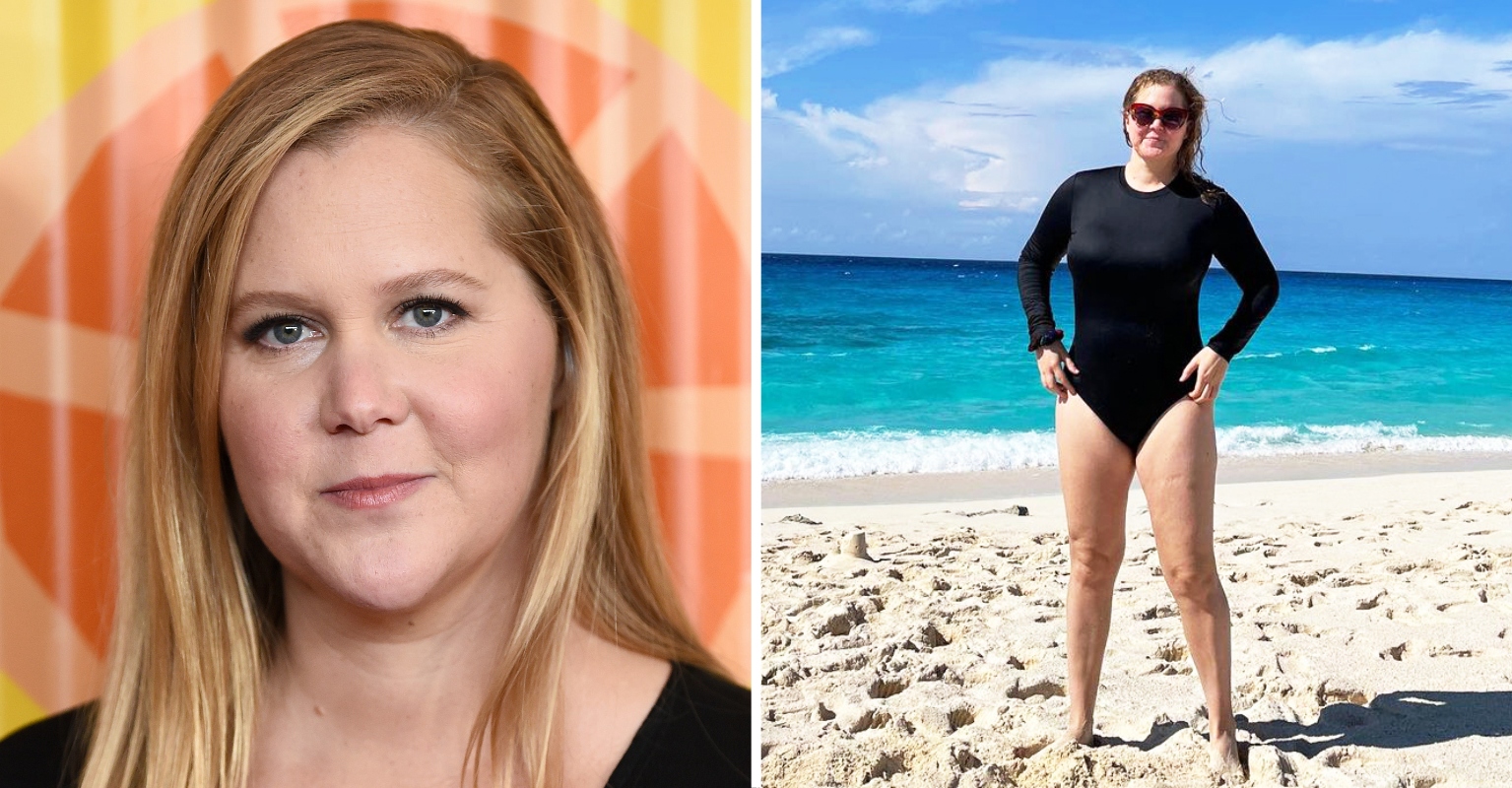 Amy Schumer Admits She Was Tired Of Looking At Herself In The Mirror Prior To Liposuction Vt