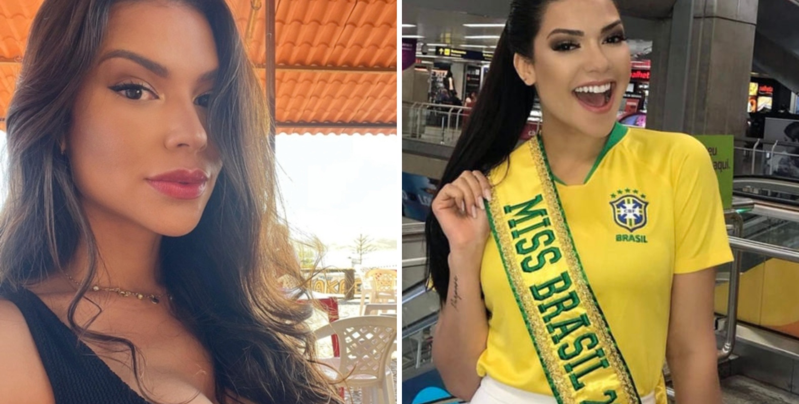 Miss Brazil 2018 Dies Following Routine Tonsil Operation