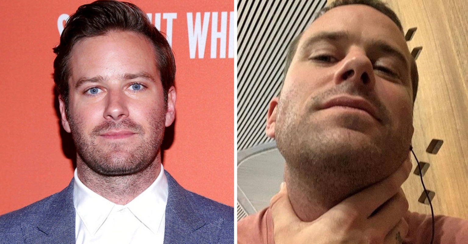 Armie Hammer s Alleged Victims Share Texts And Voice Memos In New House Of Hammer Doc VT