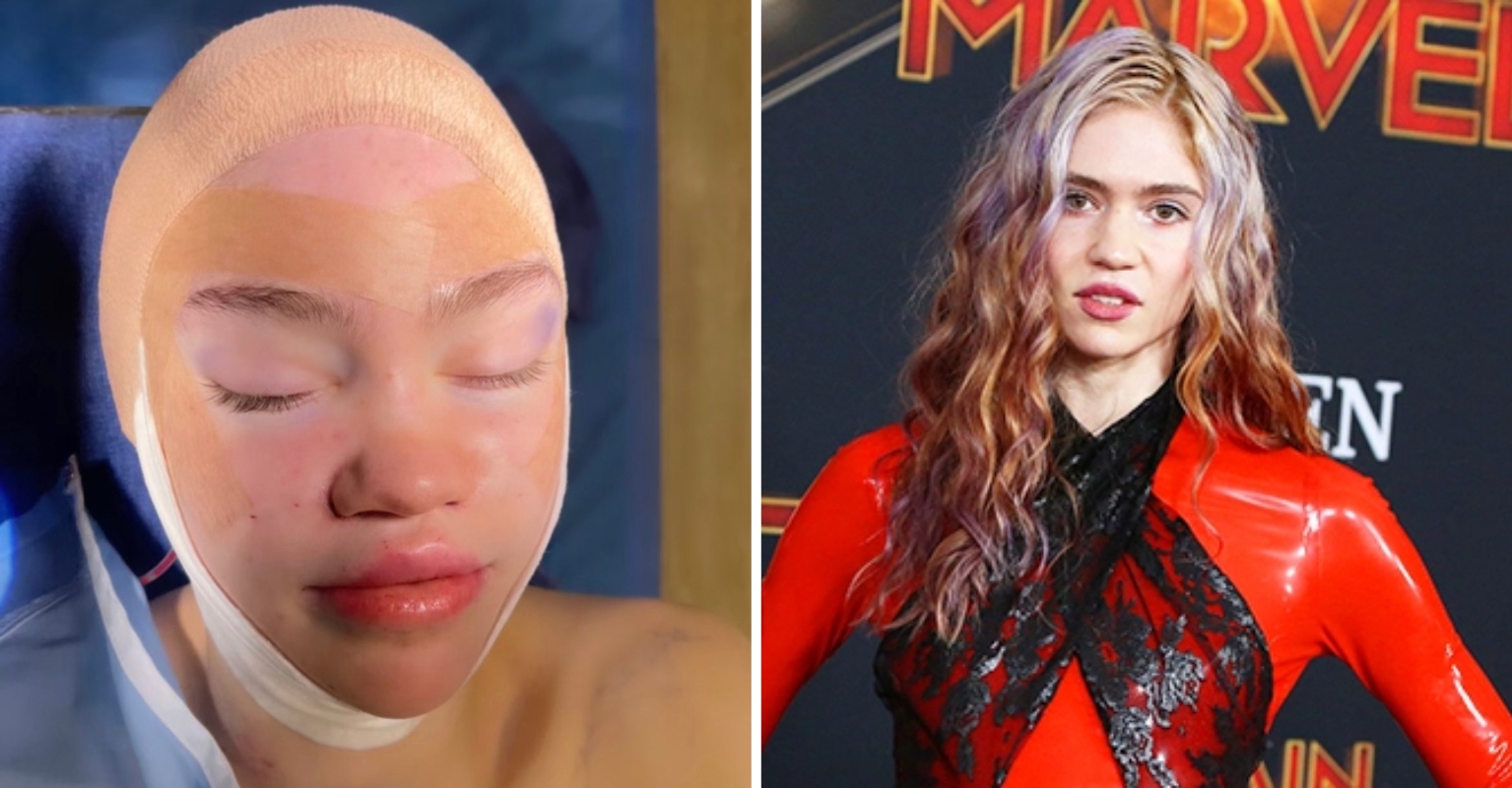 Grimes Sparks Concern After Sharing Photo Of Her Bandaged, Swollen Head ...