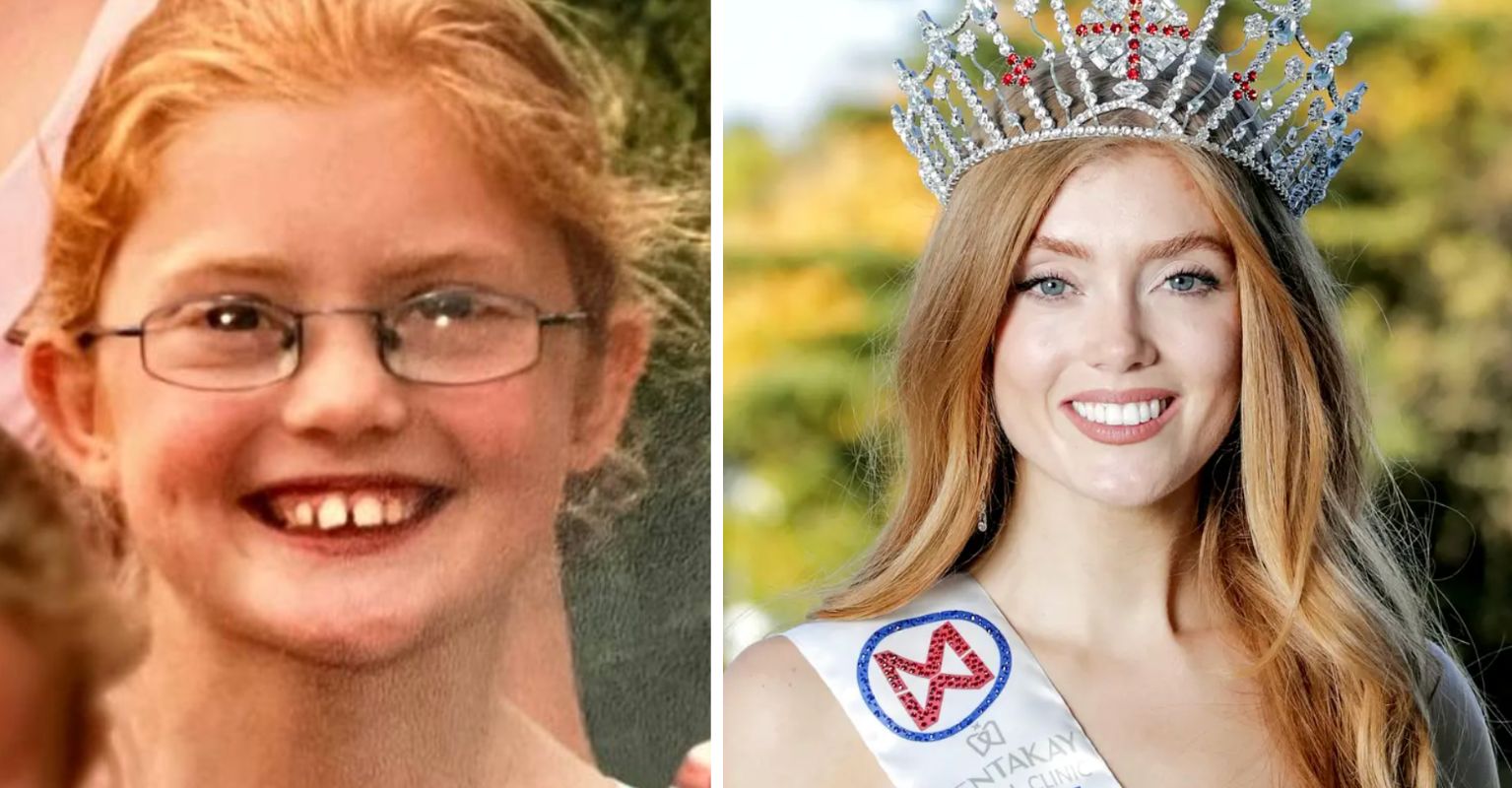 Aerospace Engineering Student Who Was Bullied For Ginger Hair Crowned ...