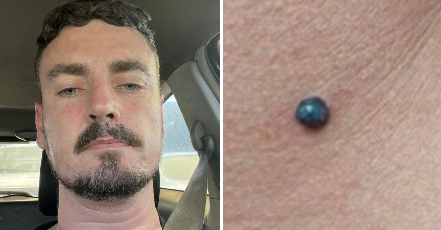Man Given 6 Months To Live After Hairdresser Urged Him To Get ...
