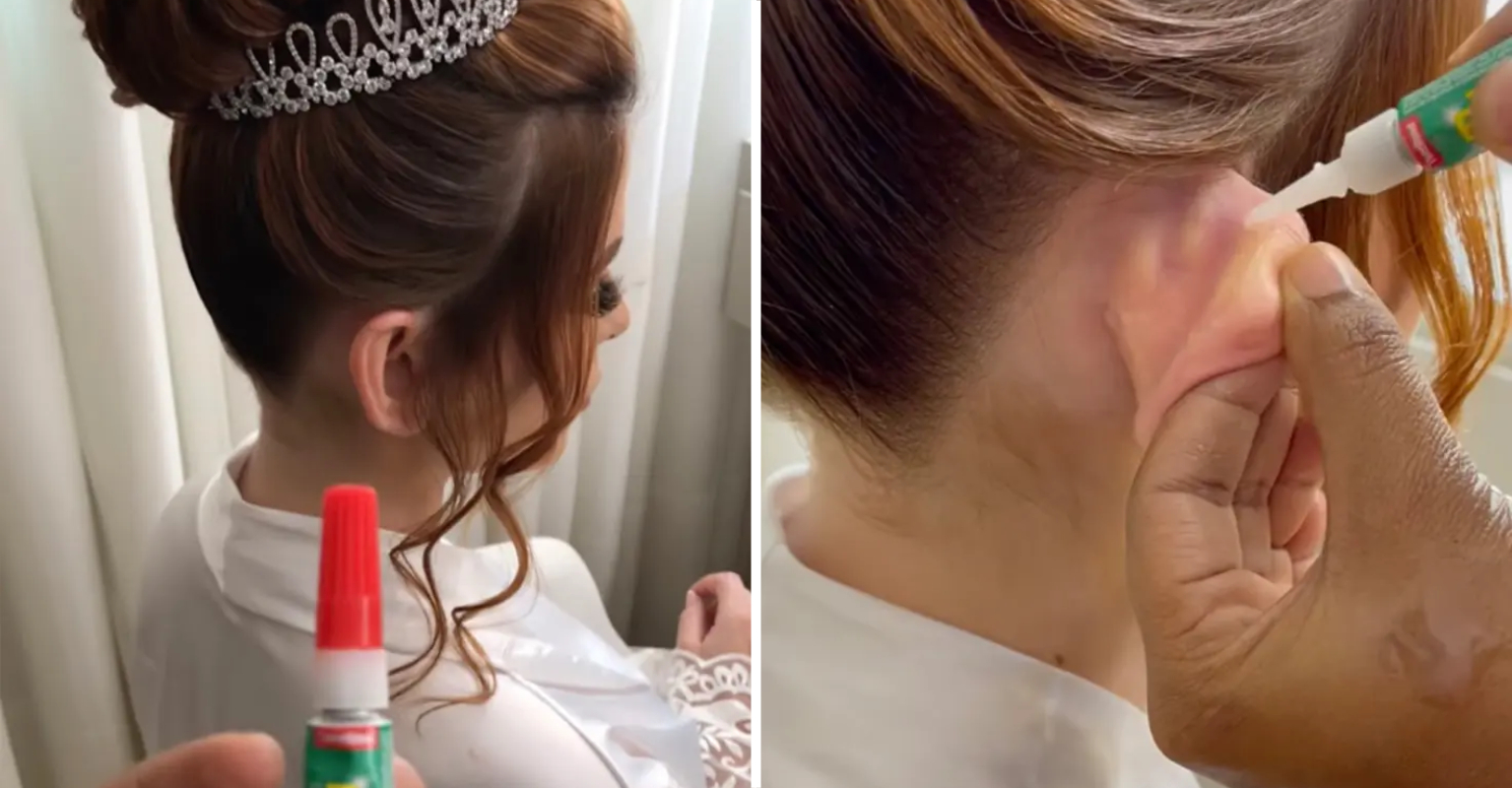 Bride Superglues Ears To Her Head On Wedding Day