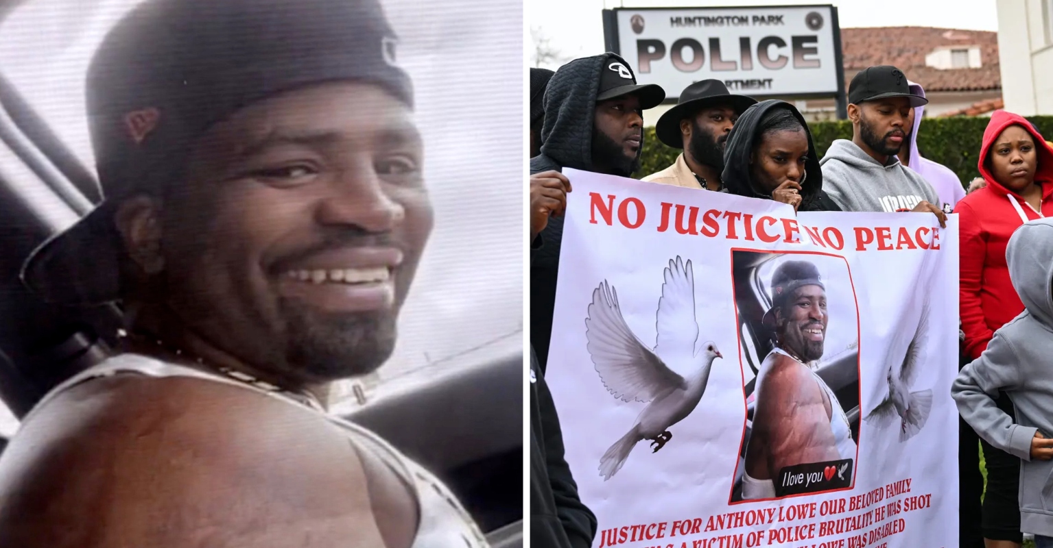 Man Missing Both Legs Dies After Being Shot By Police Multiple Times