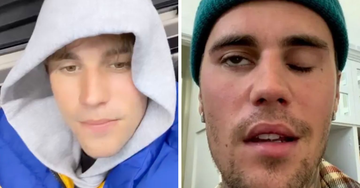 Justin Bieber Shares Health Update Following Ramsay Hunt Syndrome Diagnosis