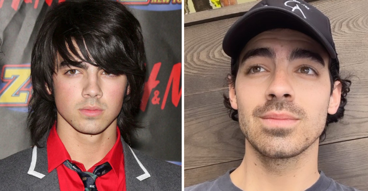 Joe Jonas Speaks Out On His Cosmetic Procedures: 'We're All Getting Older'