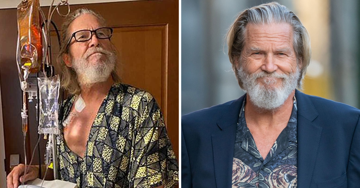 Jeff Bridges Says His Tumor Is Now The 'Size Of A Marble'