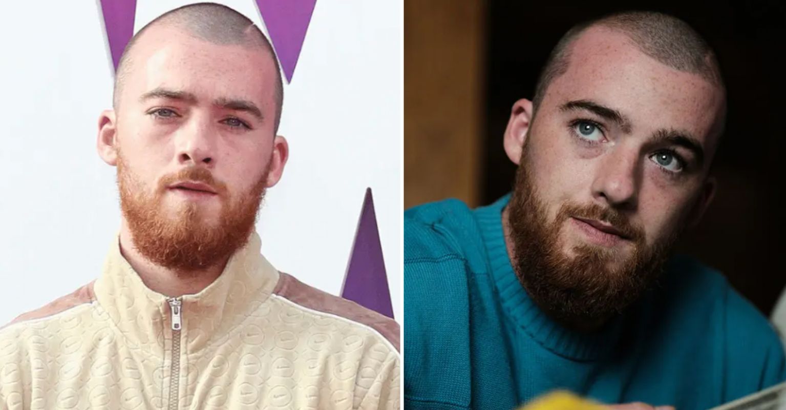 'Euphoria' Star Angus Cloud's Cause Of Death Confirmed