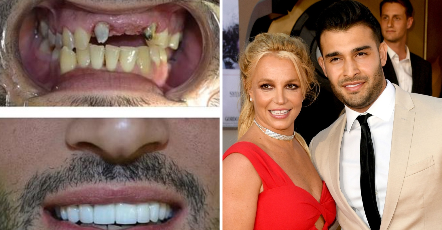 Sam Asghari Underwent Dramatic Transformation Before Marrying Britney ...