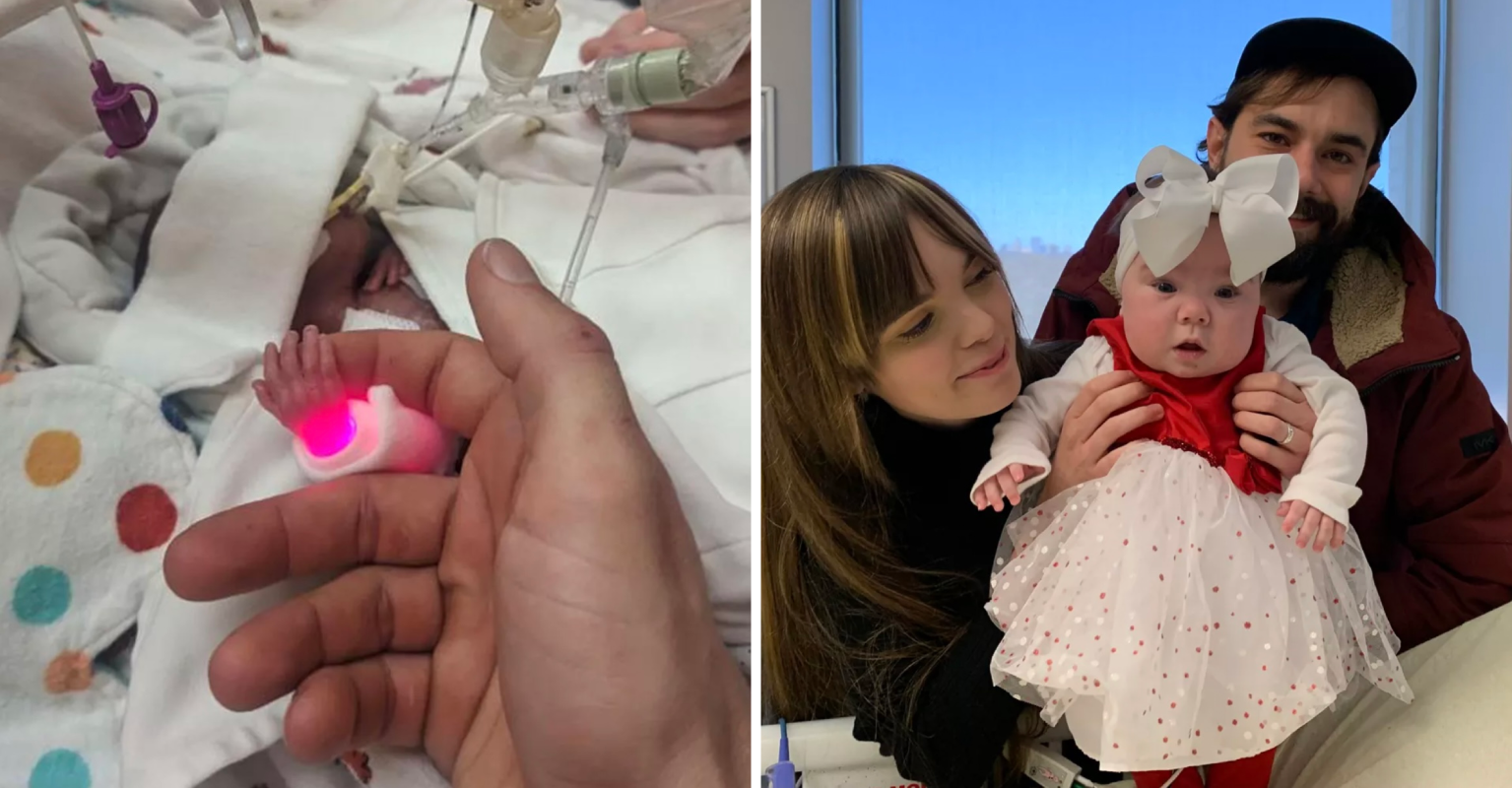 Baby Girl Born 4 Months Early And Weighing Less Than 1lb Is Finally ...