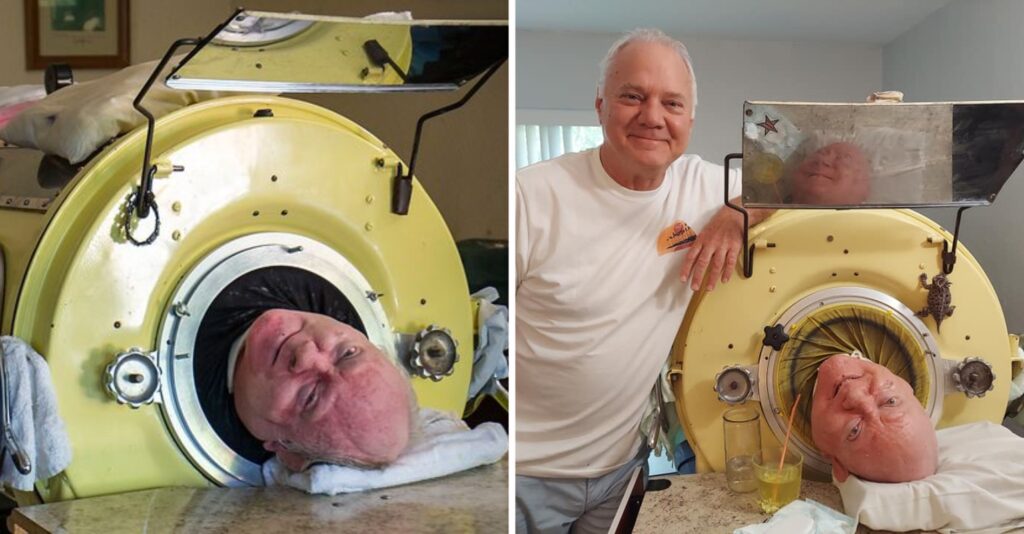 Brother Of Man Who Spent 70 Years Living Inside Iron Lung Pays Tribute ...