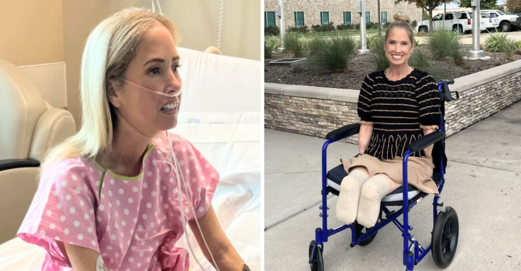 Texas Teacher’s Limbs Became ‘Mummified’ After Going To ER With What ...