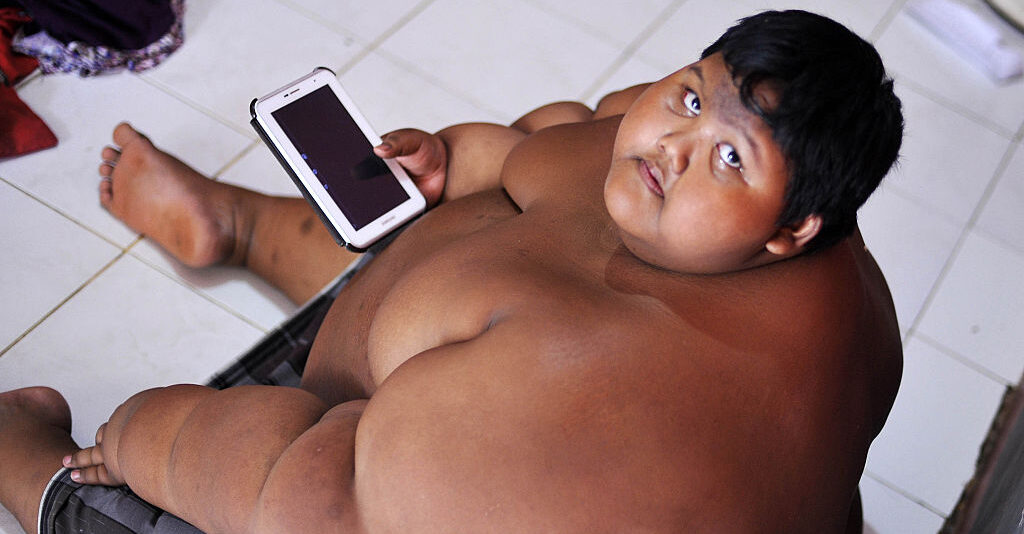 Former 'world's fattest boy' is unrecognizable after losing half his ...