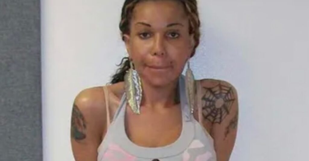 Fake Doctor Injected Patients With Tyre Sealant And Cement To Give Them ...